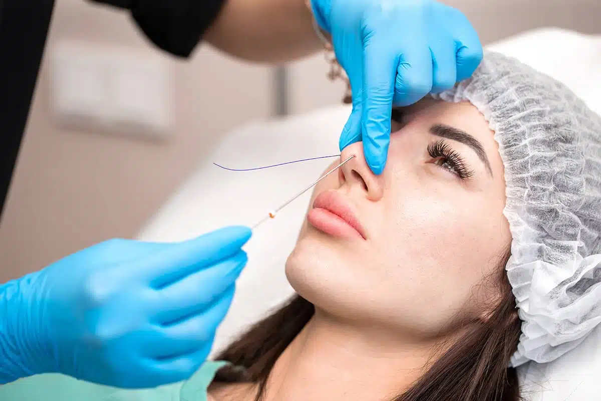 2 Best Alternatives for Rhinoplasty: Less Invasive Options