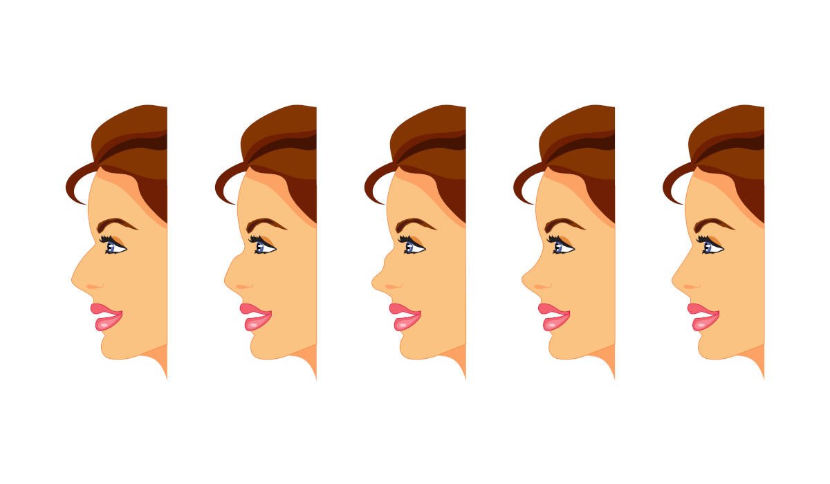 What Are The Different Types Of Noses New Jersey